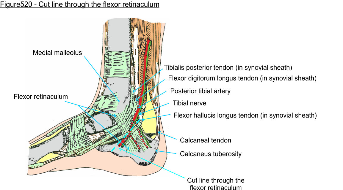 SG-LOWER LIMB FOOT