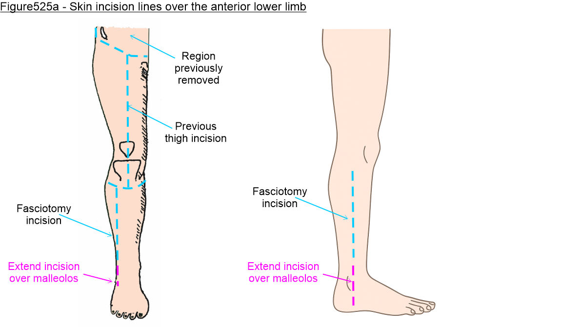 SG-LOWER LIMB ANTERIOR