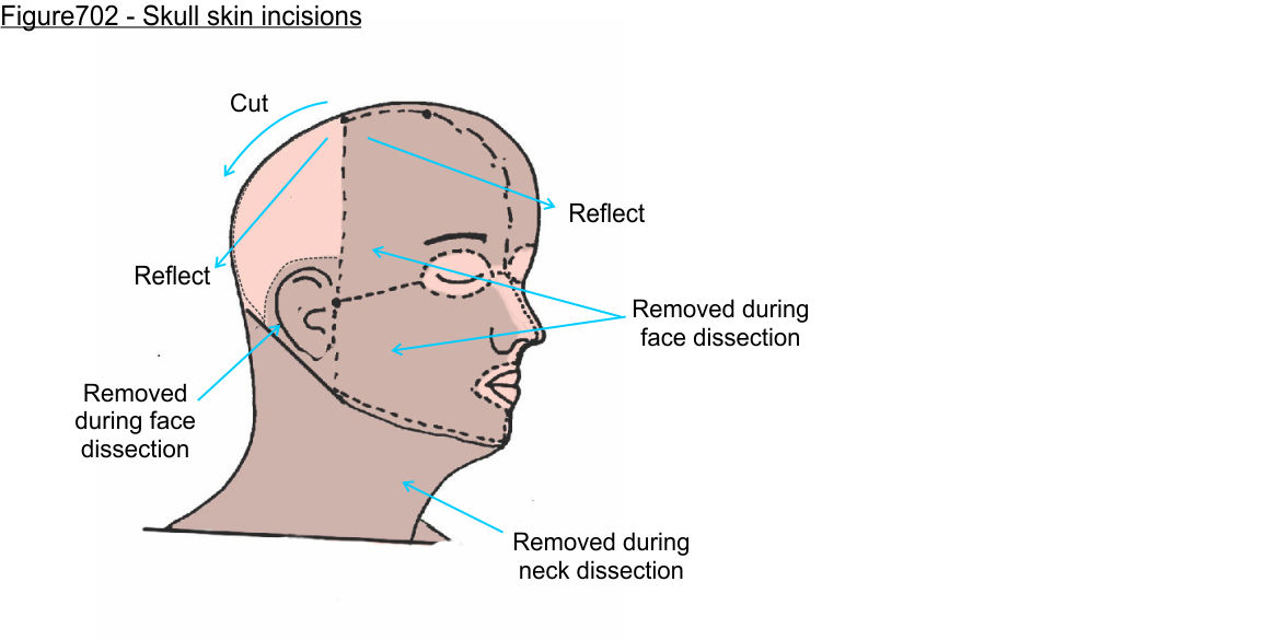 Figure702_SkullSkinIncisions
