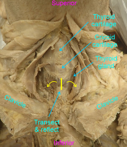 Clinical Tracheostomy