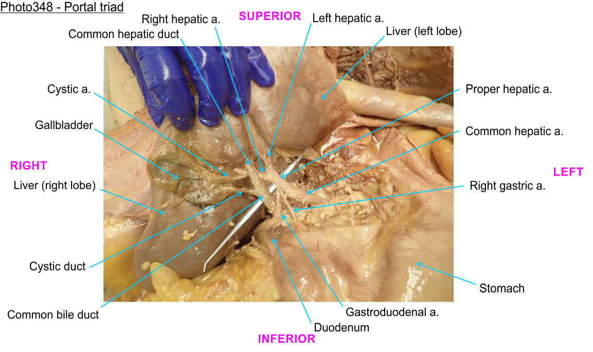 Fetal Pig Gallbladder Cystic Duct