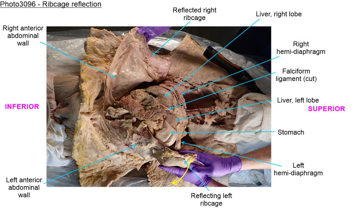 Fetal Pig Gallbladder Cystic Duct