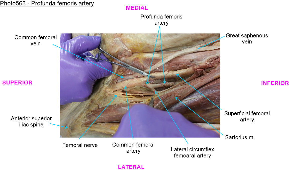 SG-LOWER LIMB ANTERIOR