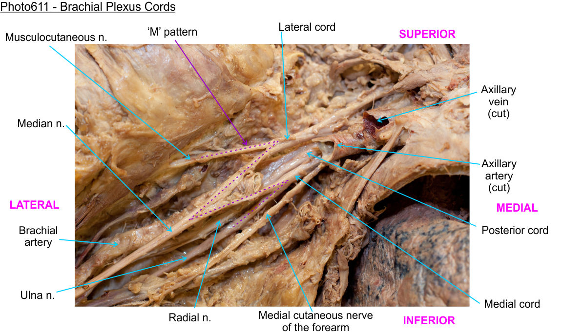 Axillary Artery Cadaver