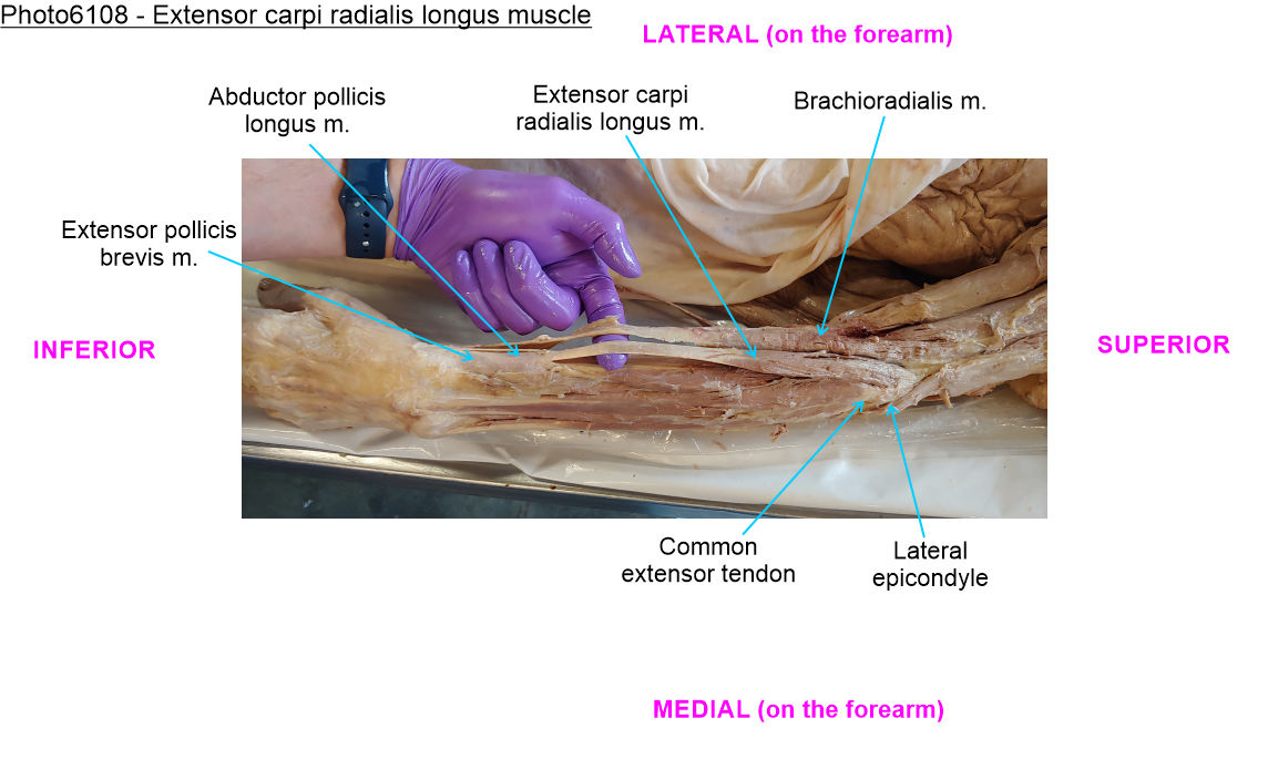 SG-UPPER LIMB FOREARM POSTERIOR