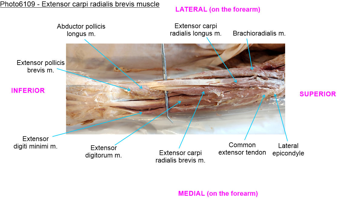 SG-UPPER LIMB FOREARM POSTERIOR