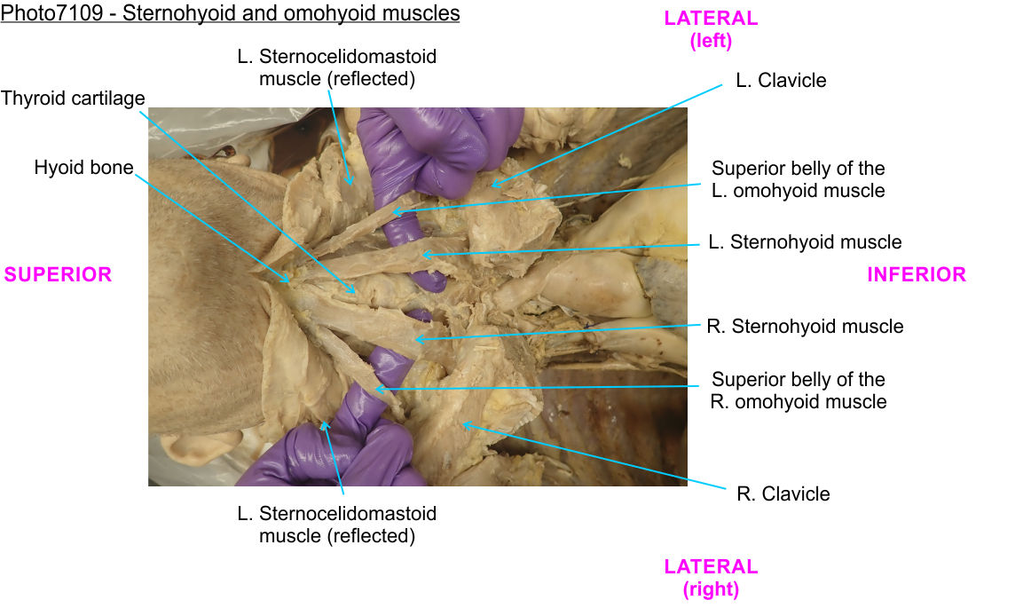 SG-ROOT OF NECK