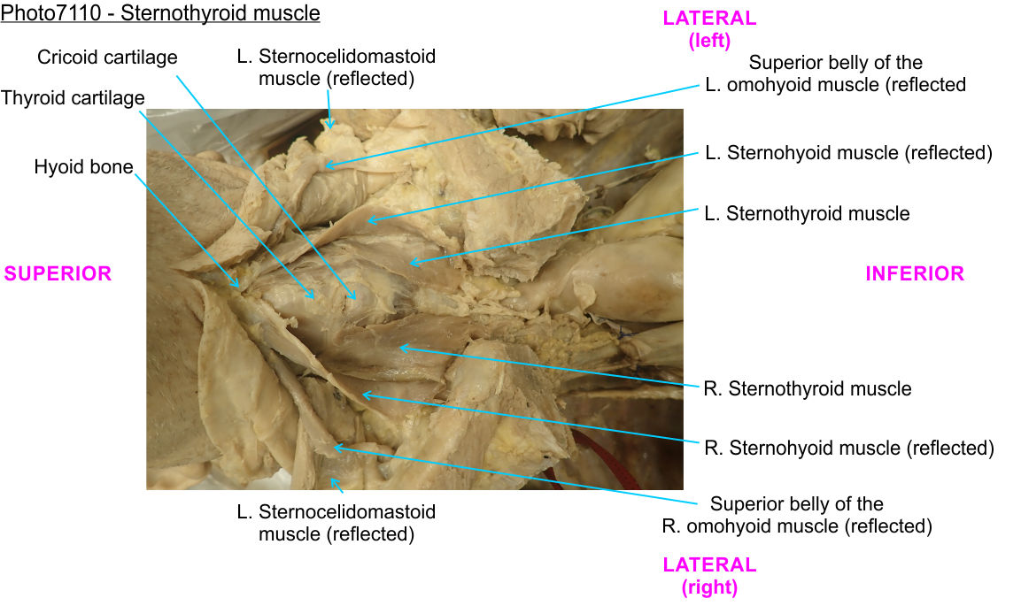 SG-ROOT OF NECK
