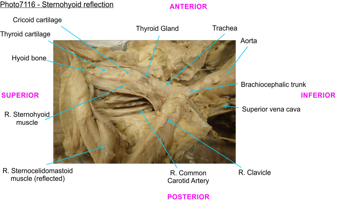 SG-ROOT OF NECK