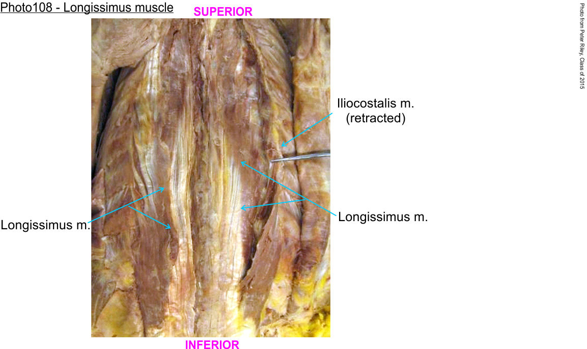 Photo1008_Longissimus